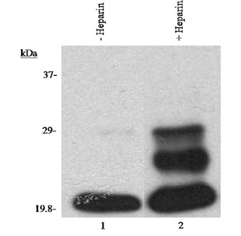 Detection Of Phosphorylation In Capacitated Sperm Fractions X Ray Film Download High