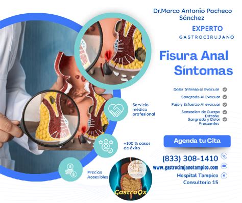 Fisura Anal Cirugía Tratamiento Eficaz Drmarcoantonio Pacheco
