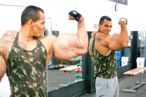 What Is Synthol Uses Abuse And Injection Effects