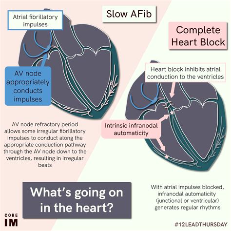 85m With A History Of Afib Cad Sp Pci Presents With Syncope Core Im