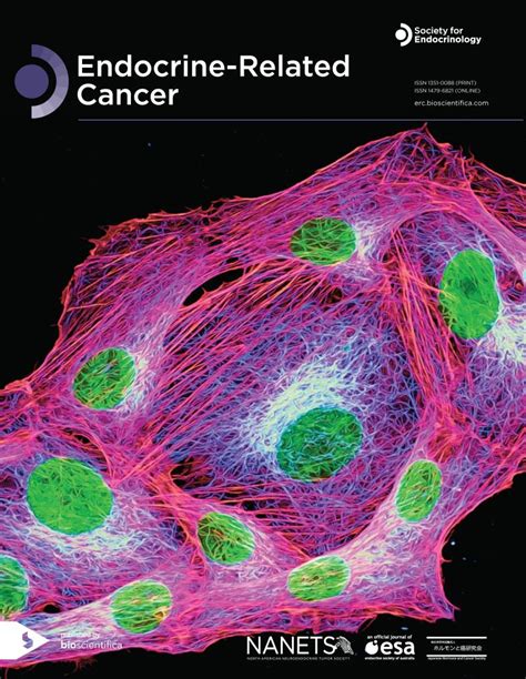 Baloch Zubair On Linkedin The 2022 Who Classification Of Thyroid Tumors Novel Concepts In…