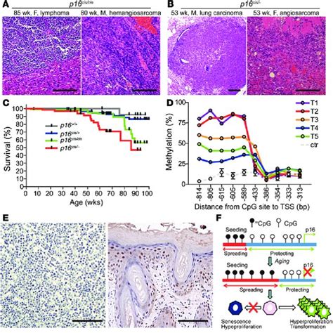 The Driving Role Of P16 Epimutation In Tumorigenesis In Vivo A And B Download Scientific
