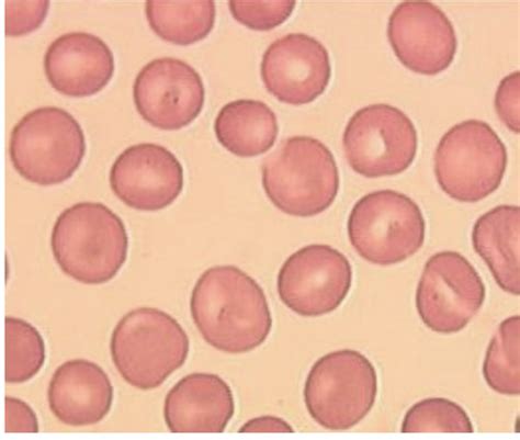 Lab Exam Flashcards Quizlet