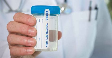 How Does Random Drug Testing Work Usa Mobile Drug Testing