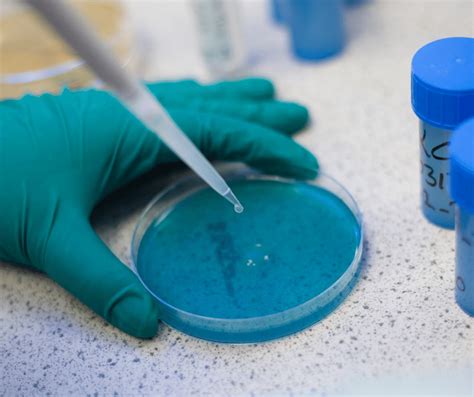 Analysis By Direct Plating Murphy And Son