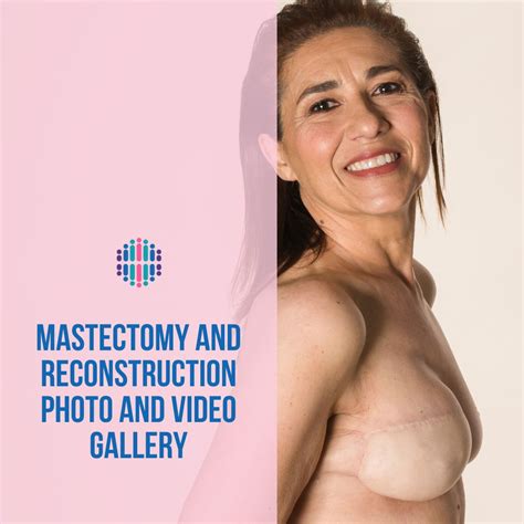 Facing Mastectomy Force Facing Our Risk Of Cancer Empowered