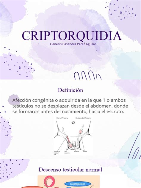 Criptorquidia Exp Pdf