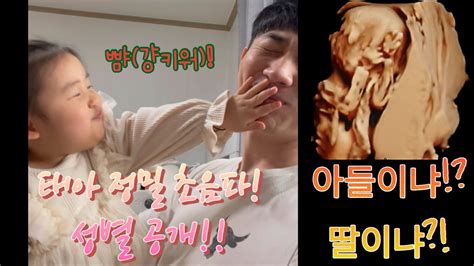 태아 정밀초음파 성별반전 성별 공개 및 육아 브이로그 Youtube