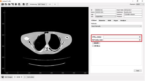 Display For Entering Ctdi Vol And Dlp Values Manually Download