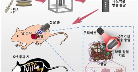 국내 연구진 암 조직 ‘직접타격 약물전달시스템 개발