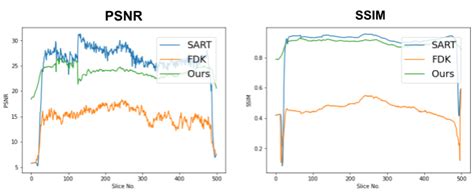 Four Dimensional Ct Using Implicit Neural Representation Preferred