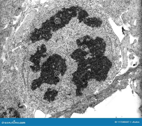 Mitosis Tem Micrograph Stock Image Image Of Biology 117240447