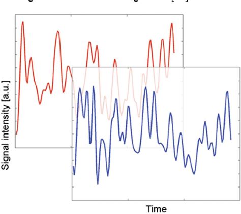 Figure 1 From Resting State Network Functional Connectivity Analysis A Multimodal Imaging And