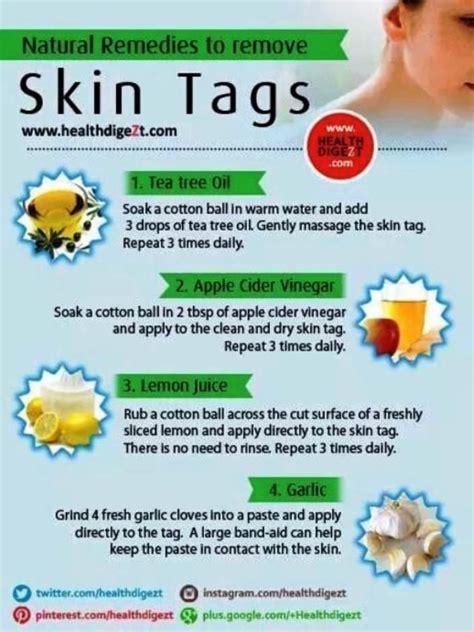 Does Lemon Juice Get Rid Of Skin Tags At Darlene Gilbert Blog