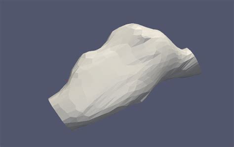 Result Of Segmenting Plaque Manually From 3d Us Image Of Carotid Download Scientific Diagram