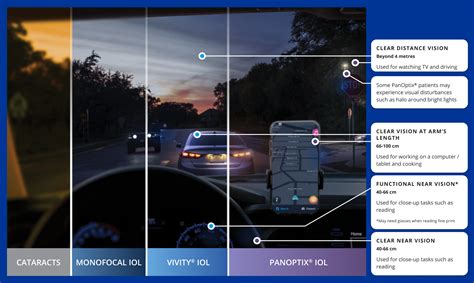 Cataract Vision Simulation