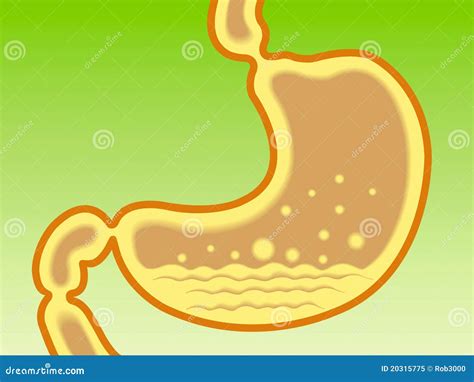 Gastric Acidity Stock Vector Illustration Of Pathology 20315775