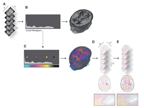 Advancing Surgical Precision A Deep Dive Into Soft Tissue Bitmap Printing For Surgical Planning