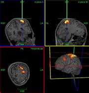 LOCALITE TMS Navigator