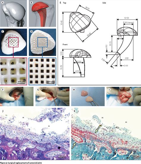 Synovial Joint Structure Semantic Scholar