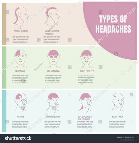 Infographic On Different Types Headaches According Stock Vector