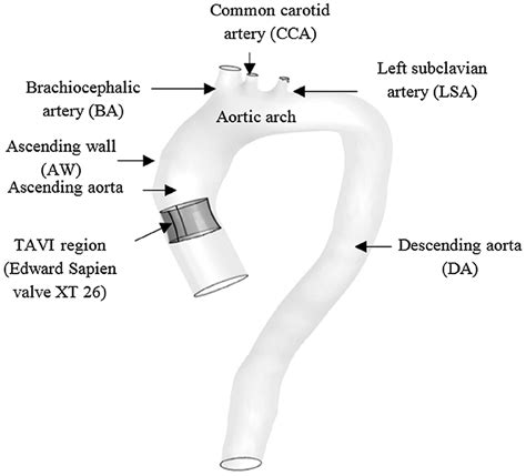 3d Aorta Model With Valve Using Catia Software Download Scientific