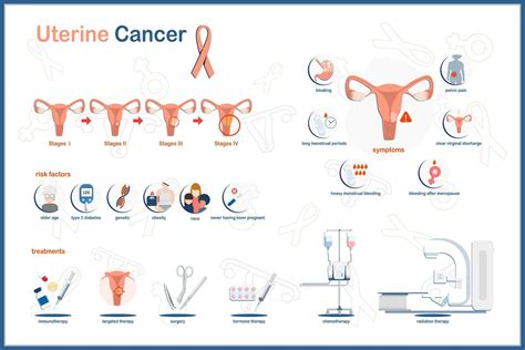 Medical Vector Illustration Uterine Cancer Infographic Symptoms Of