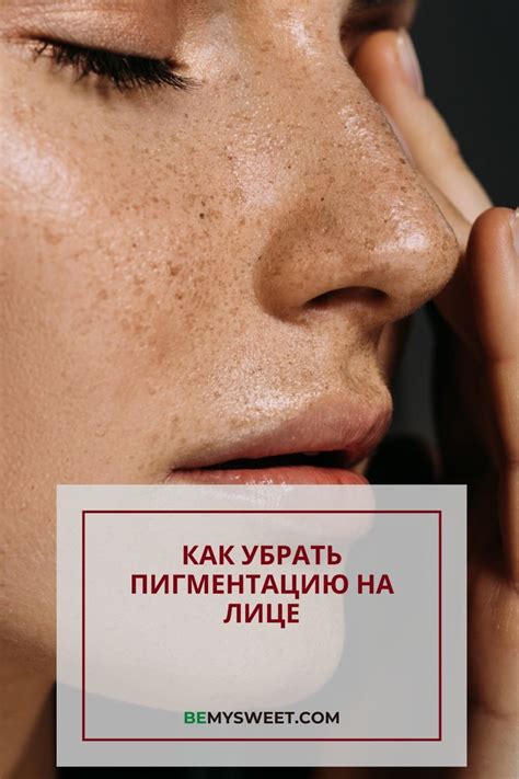 Как убрать пигментацию на лице Лицо Веснушки Косметология