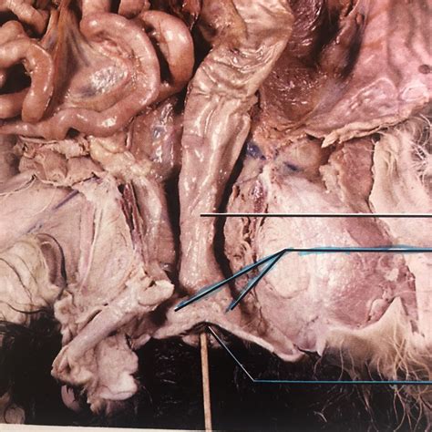 Diagram Of Digestive System 10 Quizlet
