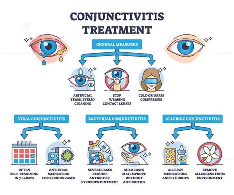 Conjunctivitis Treatment For Bacterial And Allergic Type Outline