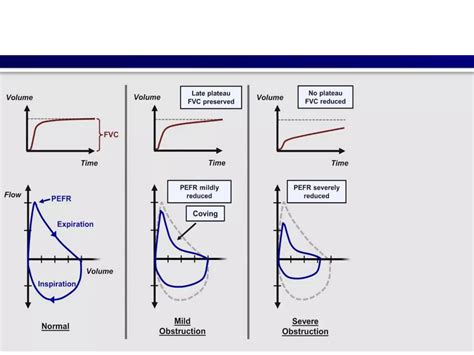 Interpretation Of Pulmonary Function Test PPTX Lung And Respiratory Health Diseases And