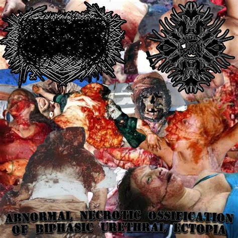 Abnormal Necrotic Ossification Of Biphasic Urethral Ectopia