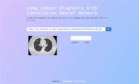 GitHub nonkung lung cancer diagnose AI วนจฉยมะเรงปอดดวย Keras และ Flask https medium