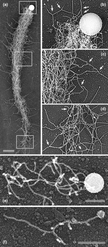 Dendritic Organization Of Actin Comet Tails Current Biology