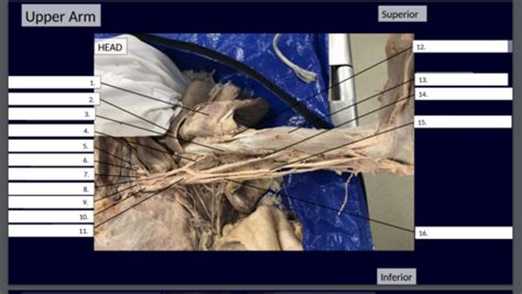 Brachial Plexus Cadaver Flashcards Quizlet