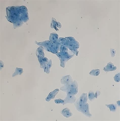 Epithelial Cells From My Cheek Stained With Methylene Blue R Microscopy