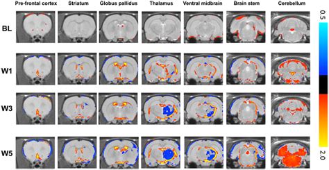 Deformation Based Morphometry Confirms And Extends Manual Segmentation Download Scientific