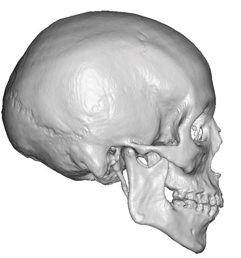 Female Narrow Head Shape 3d Ct Scan Side View Dr Barry Eppley Explore