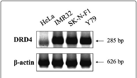 Drd4 Gene Pattern Band Formation In Patients With Adhd Download Scientific Diagram