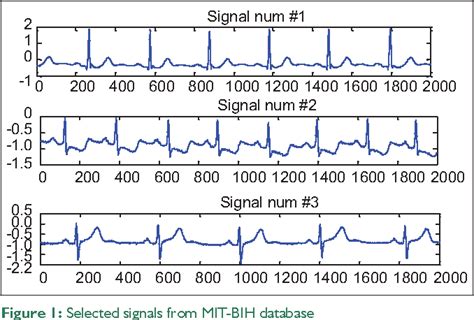 Figure 1 From R Peak Detection In Electrocardiogram Signal Based On An Optimal Combination Of