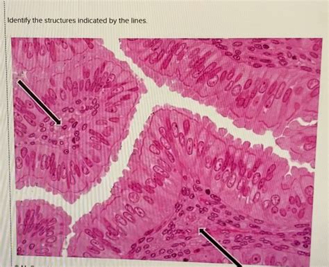 Solved Identify The Structures Indicated By The Lines