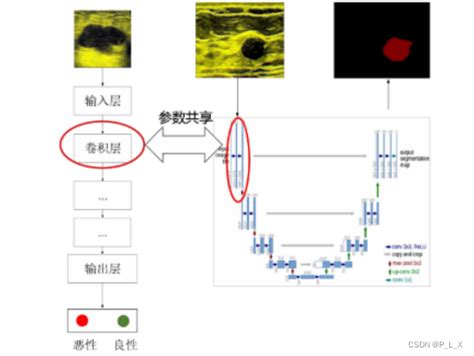 深度学习论文精读01——基于多任务学习的肿瘤医学影像语义分割与分类研究 医学影像 语义分割 组织病理 csdn博客