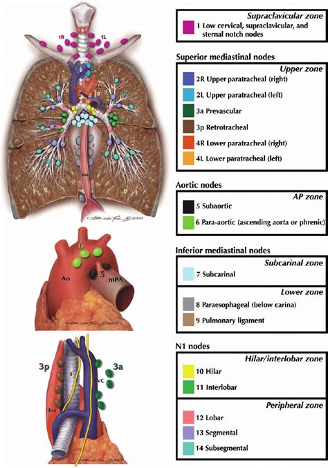 The Iaslc Lymph Node Map Including The Proposed Grouping Of Lymph Node