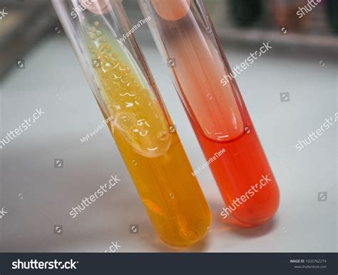 Sucrose Fermentation Test Lab Quiz 6 Flashcards Quizlet