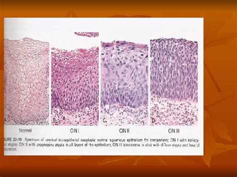 Female Genital Tract Pathology PPT
