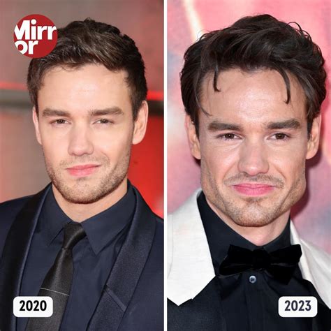 Celebrity Chin Implants