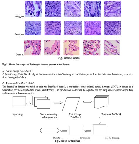 Fastai Powered Lung Cancer Classification Model