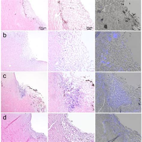 Use Of Acellular Dermal Matrices In Breast Reconstruction Acellular Download Scientific