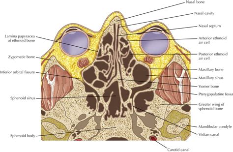 Lamina Papyracea Fracture