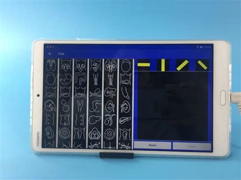 Cheapest Usb Portable Usb Probe Type Ultrasound Convex Probe Price Wireless Ultrasound Probe